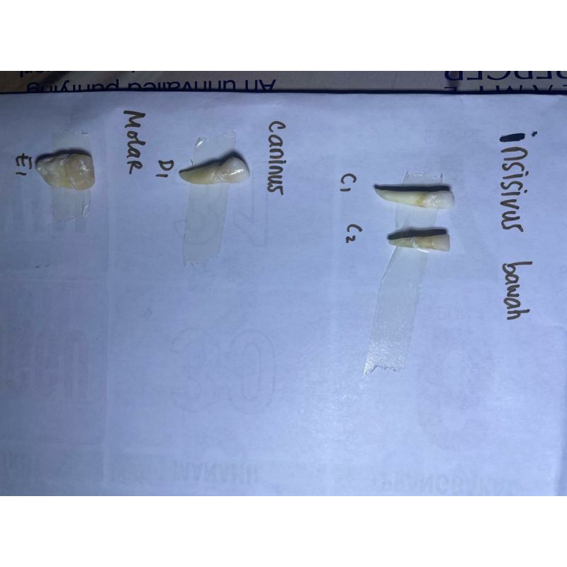 Jual gigi praktikum kedokteran gigi insisivus, caninus, premolar, molar ...