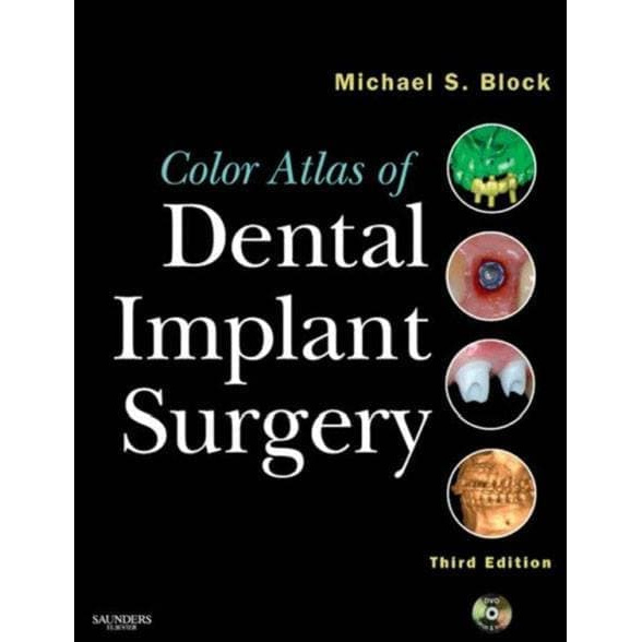 Jual Paket DVD Implant Dentistry 1 Murah | Shopee Indonesia