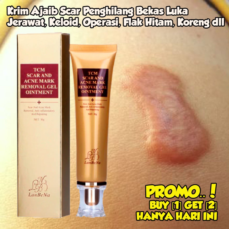 Jual Scar Penghilang Bekas Operasi, Luka, Jerawat, Keloid, Flak Hitam ...
