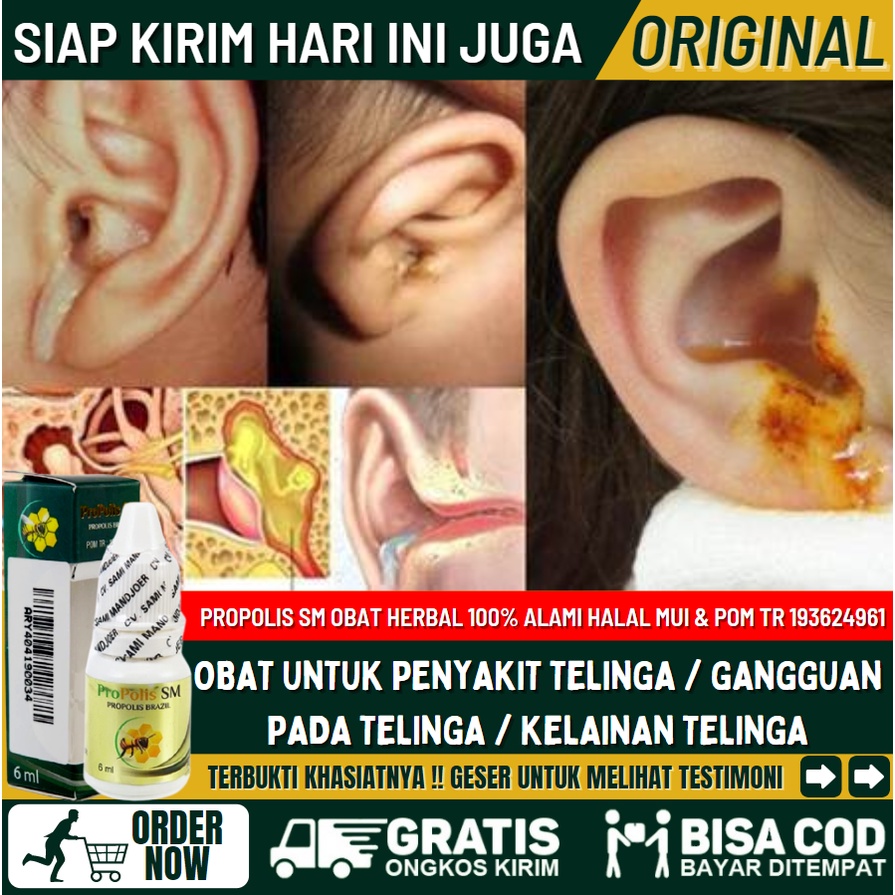 Jual Obat Tetes Telinga Curek, Congek, Keluar Darah, Telinga Keluar ...