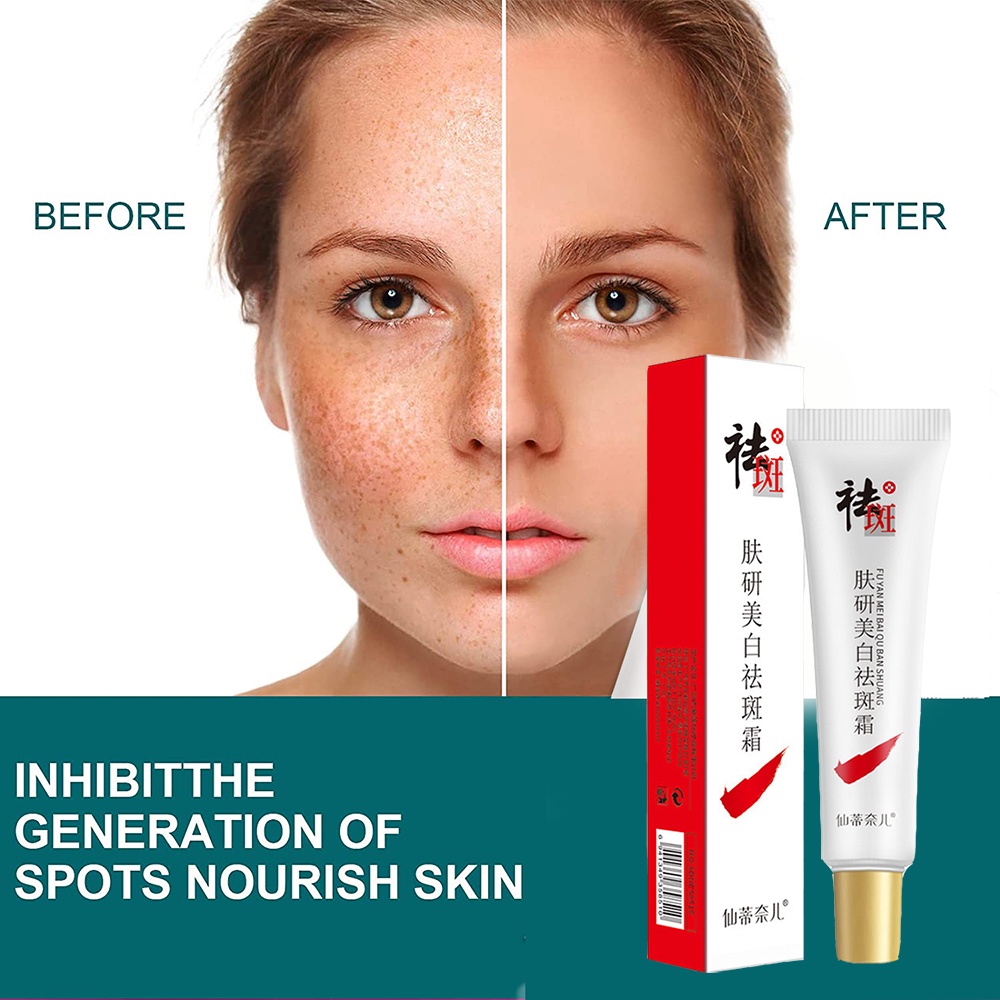 Jual Cindynal Niacinamide Skin Cream Krim Penghilang Flek Hitam Membandel | Shopee Indonesia