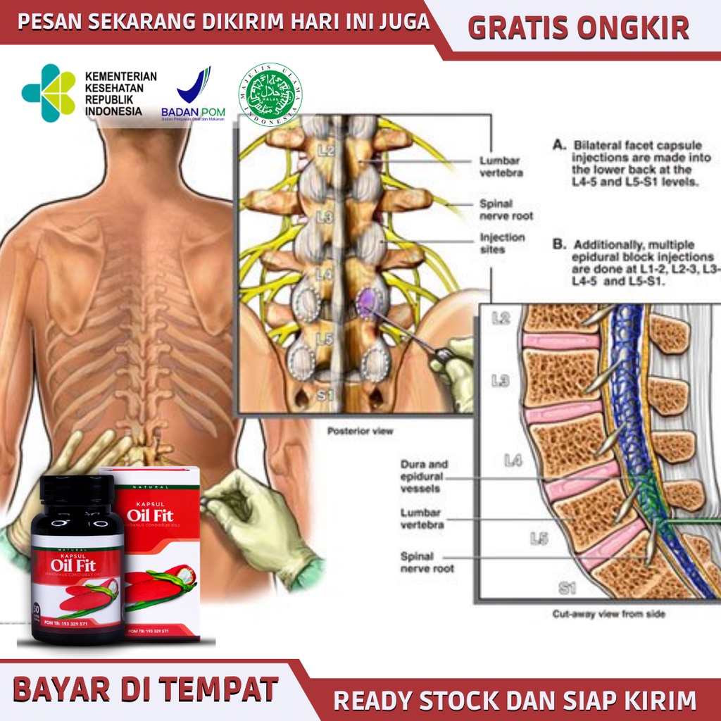 Jual Obat saraf kejepit, obat saraf kejepit di kaki, obat saraf kejepit ...