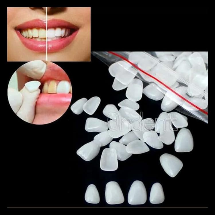 Jual Crown Gigi Veneer Super White Atas Bawah 50 Pcs | Shopee Indonesia