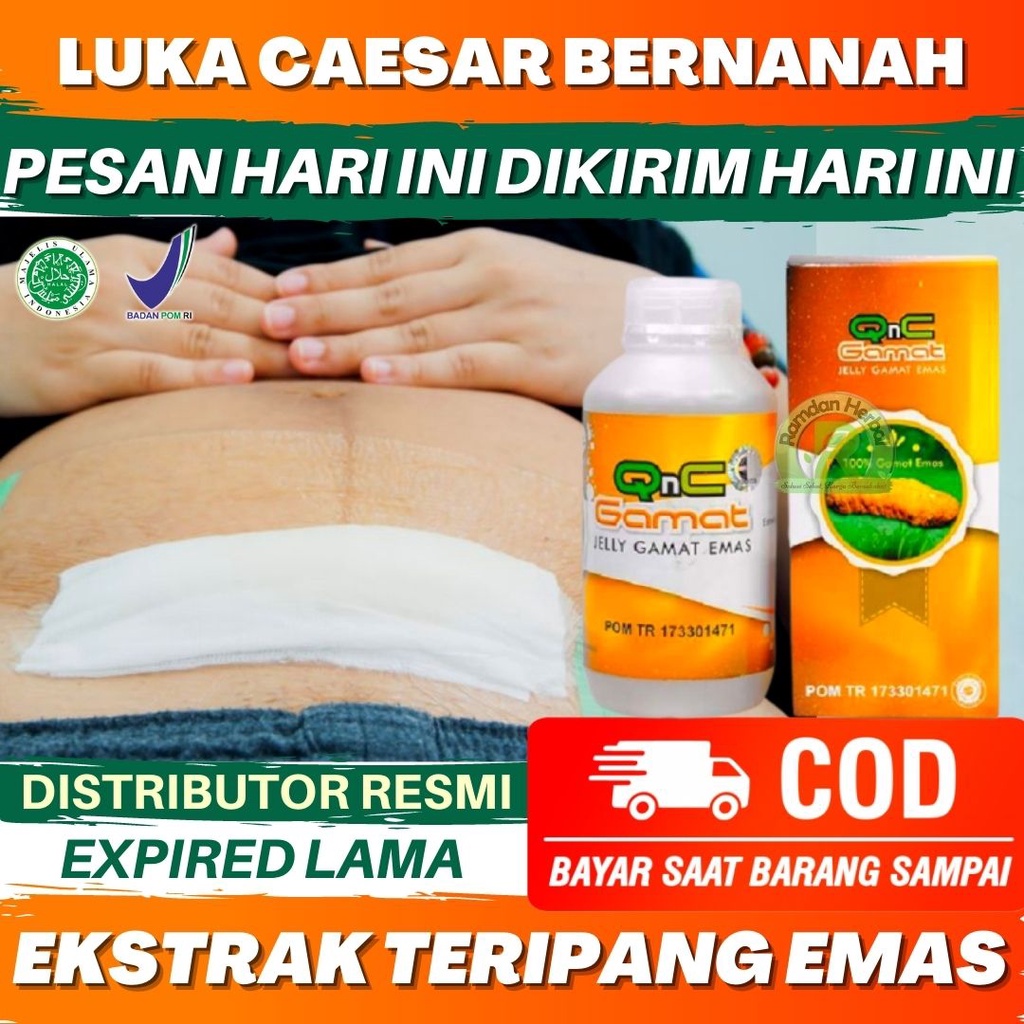 Jual COD - Obat Luka Caesar Bernanah - Pengering Luka - Penghilang ...