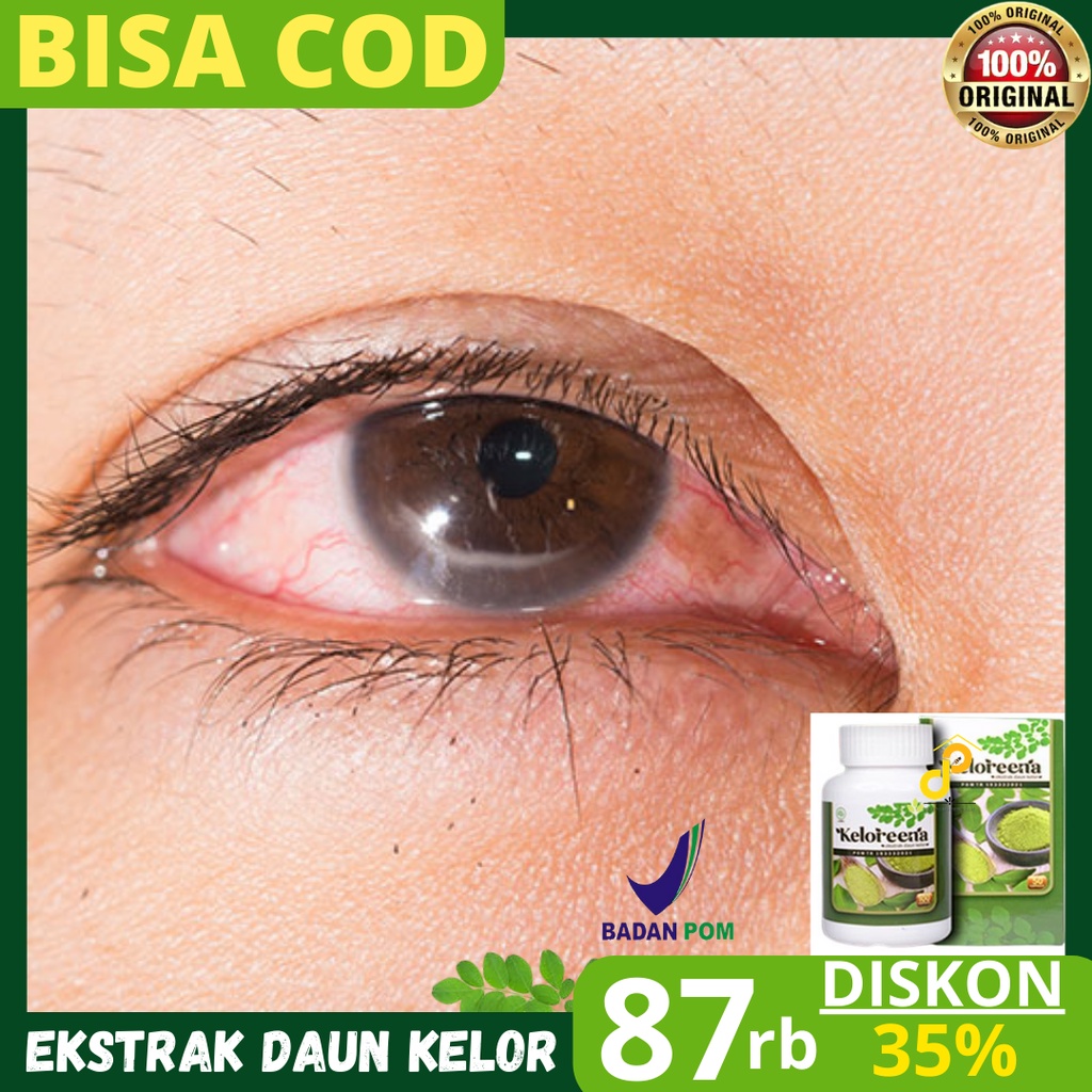 Jual KELOREENA SUPLEMEN KESEHATAN MATA COCOK UNTUK ANAK DAN DEWASA ...