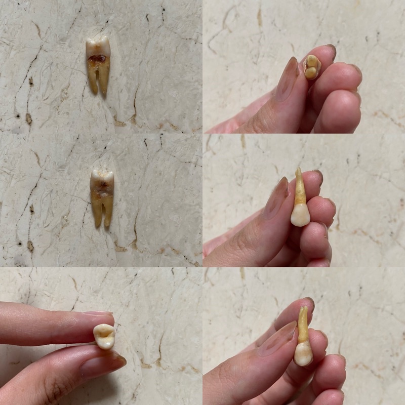 Jual gigi 14 endo konser | Shopee Indonesia