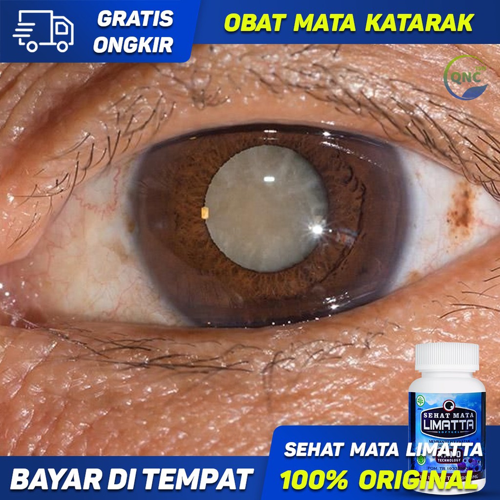 Jual Obat Mata Katarak, Katarak Traumatik, Katarak Sekunder, Katarak ...