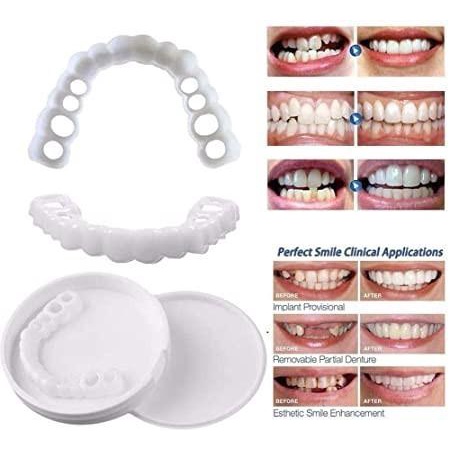 Jual Nay / Veneer Snap On Smile Gigi Palsu Silikon Berkualitas 1 Set ...