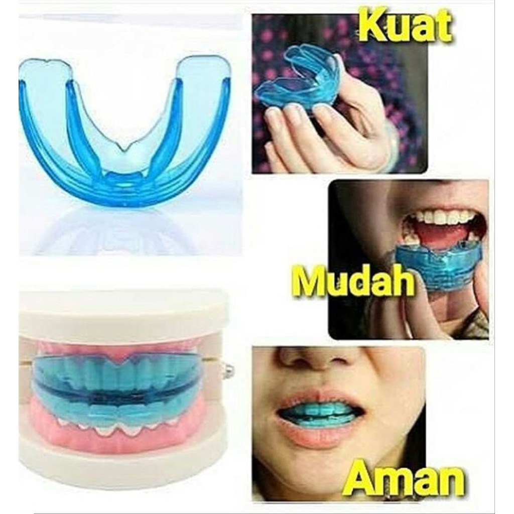 Jual PERAPI GIGI TANPA BEHEL / ALIGNMENT TRAINER DESSA DENTAL USA 1PCS ...