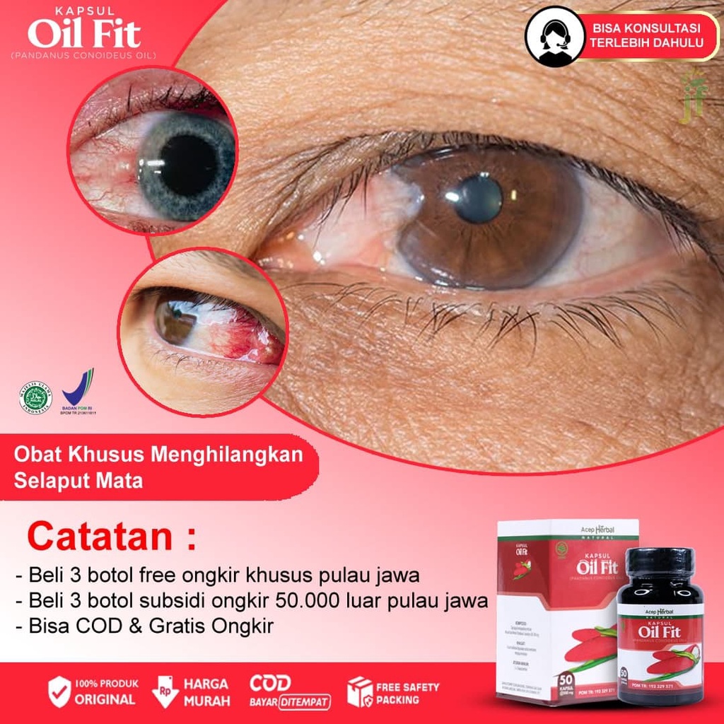 Jual Obat Menghilangkan Selaput Mata Mata, Obat Mata Pterygium, Rabun ...