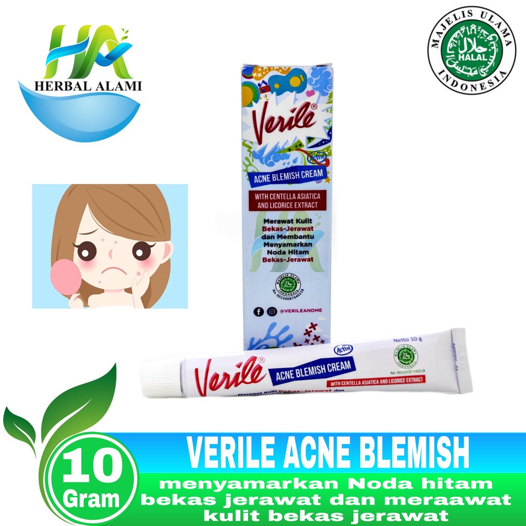 Jual Verile Acne Blemish Cream - Obat Cream Bekas jerawat,Menyamarkan ...