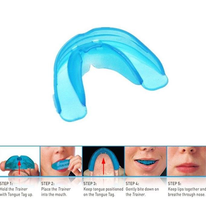 Jual Behel Gigi/Orthodentic Retainer Teeth Trainer Alignment/Merapikan ...