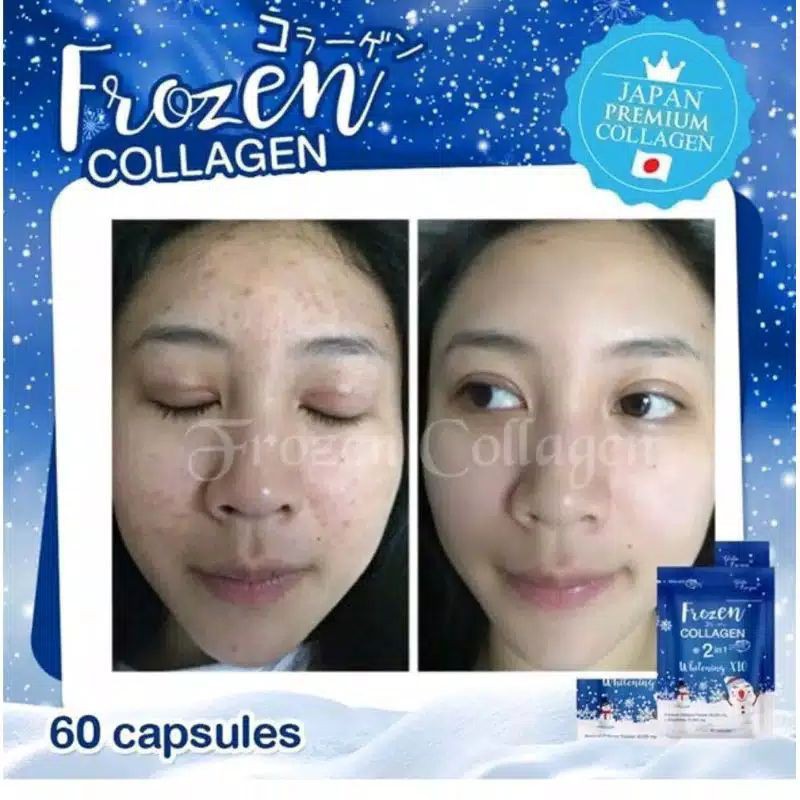 Jual ADA BARCODE) FROZEN COLLAGEN whitening 60 Kapsul | Shopee Indonesia