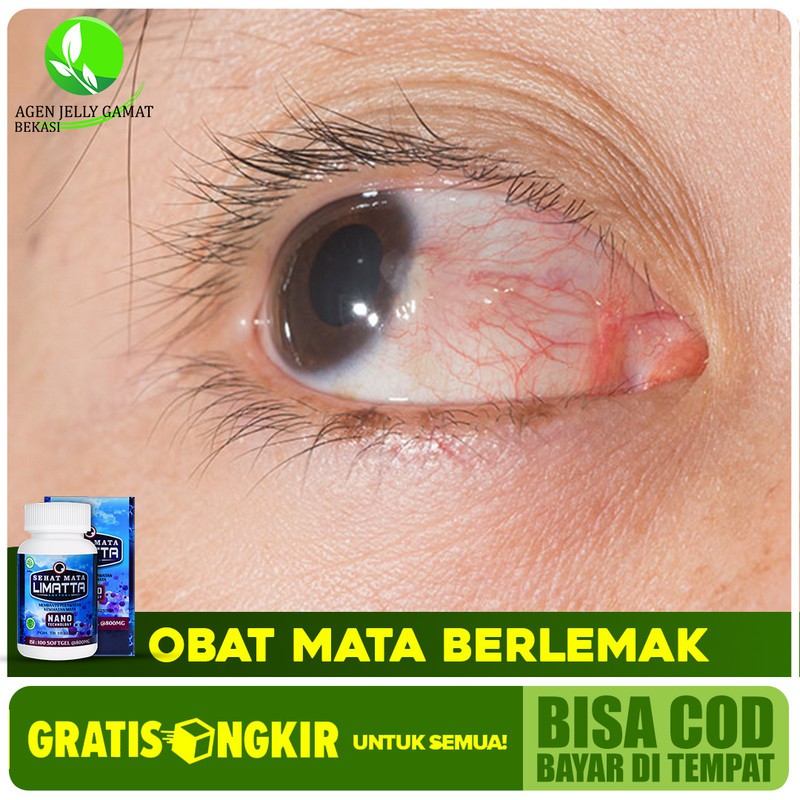 Jual Obat Mata Berlemak, Lemak Pada Mata, Pterygium Paling Aman Limatta ...