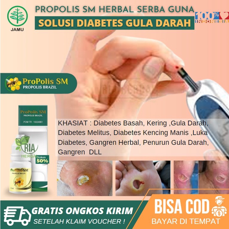Jual Obat Luka Basah Diabetes Tradisional, Salep Pengering Luka Di ...