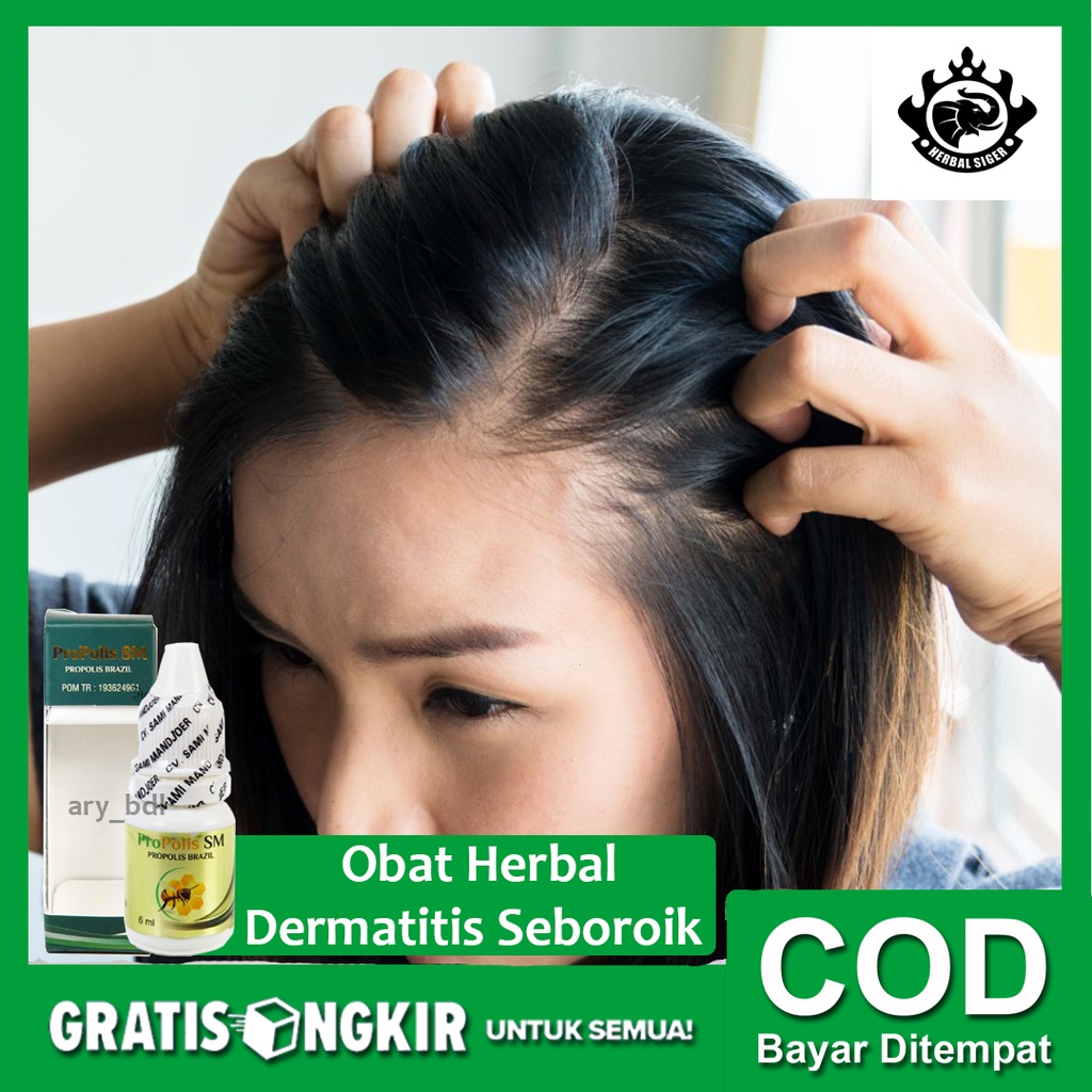 Jual Obat Herbal Dermatitis Seboroik Kulit Kepala Bersisik Berkerak Berwarna Kemerahan dan ...