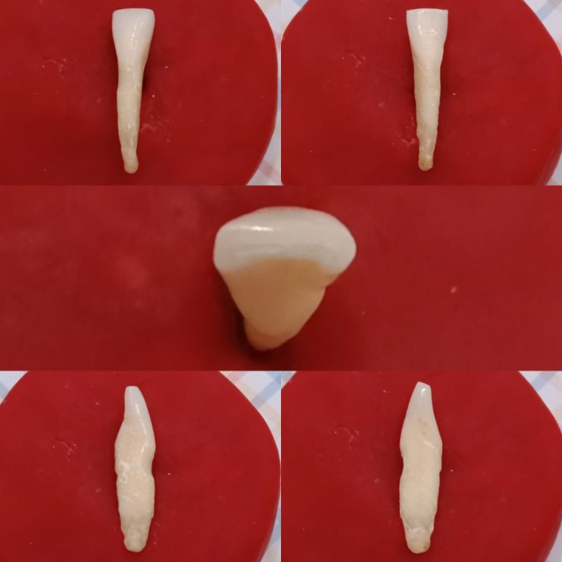 Jual Gigi 31 Gigi Asli Praktikum Gigi Insisif Sentral Kiri Rahang Bawah ...