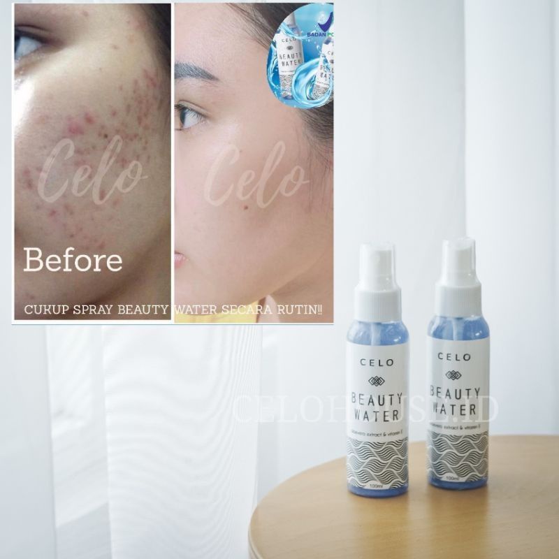 Jual CELO Facemist Beauty Water Aloevera dan Vitamin E 100gr | Shopee ...