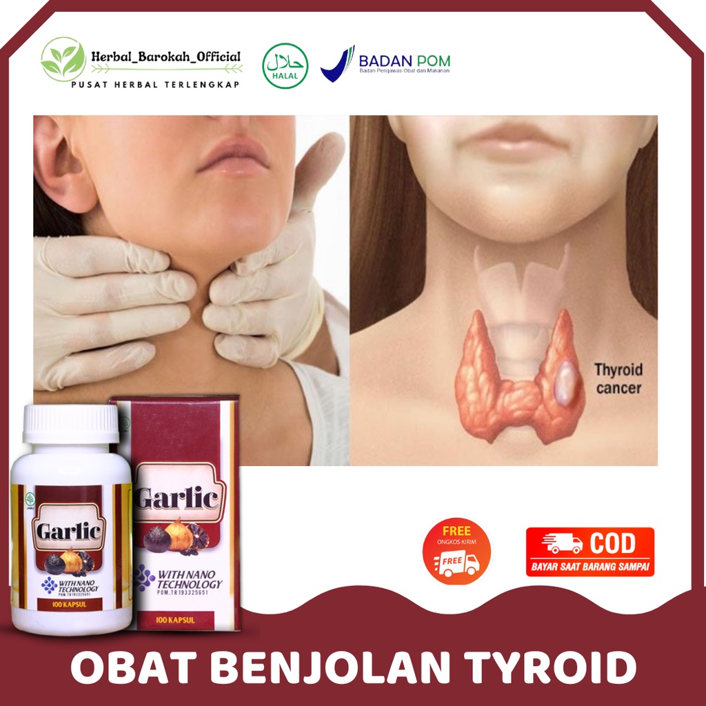 Jual Obat Penghilang Benjolan Tiroid Tyroid, Hipertiroid, Hipotiroid ...