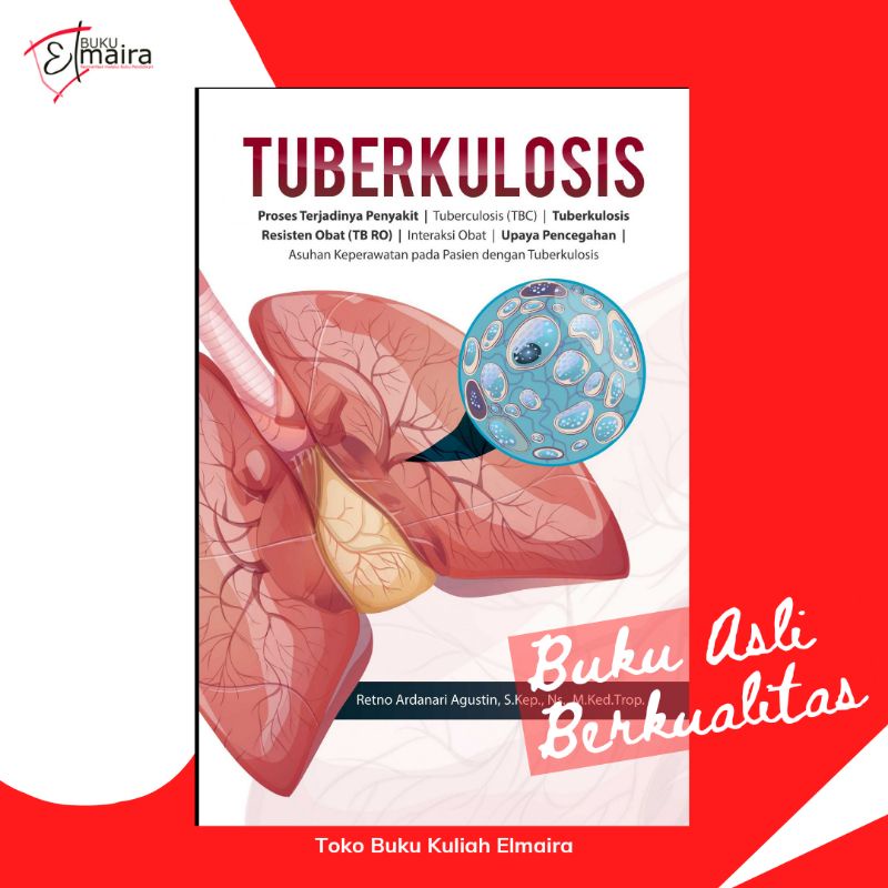 Jual Buku Tuberkulosis Tuberculosis Tuberkolosis Retno Ardanari Agustin Deepublish | Shopee ...