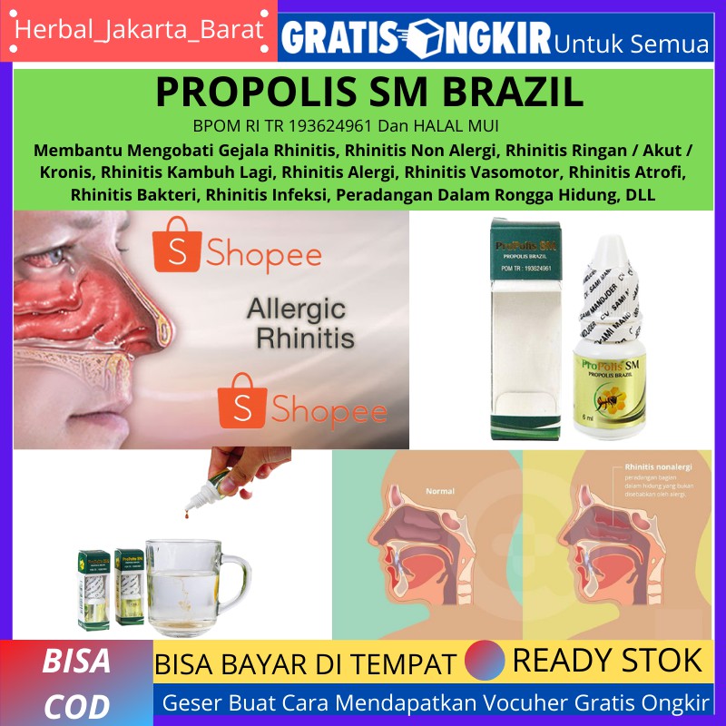 Jual Obat Untuk Rhinitis Vasomotor, Rhinitis Atrofi, Rhinitis Bakteri ...