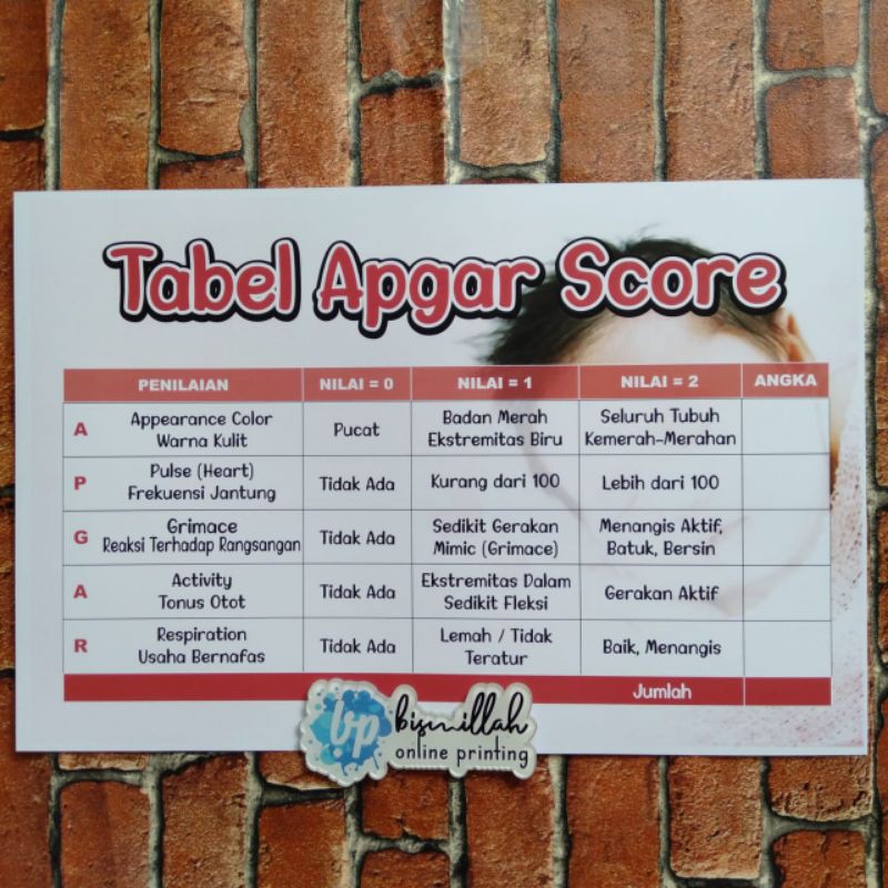 Jual Poster kebidanan tabel Apgar Score | Shopee Indonesia