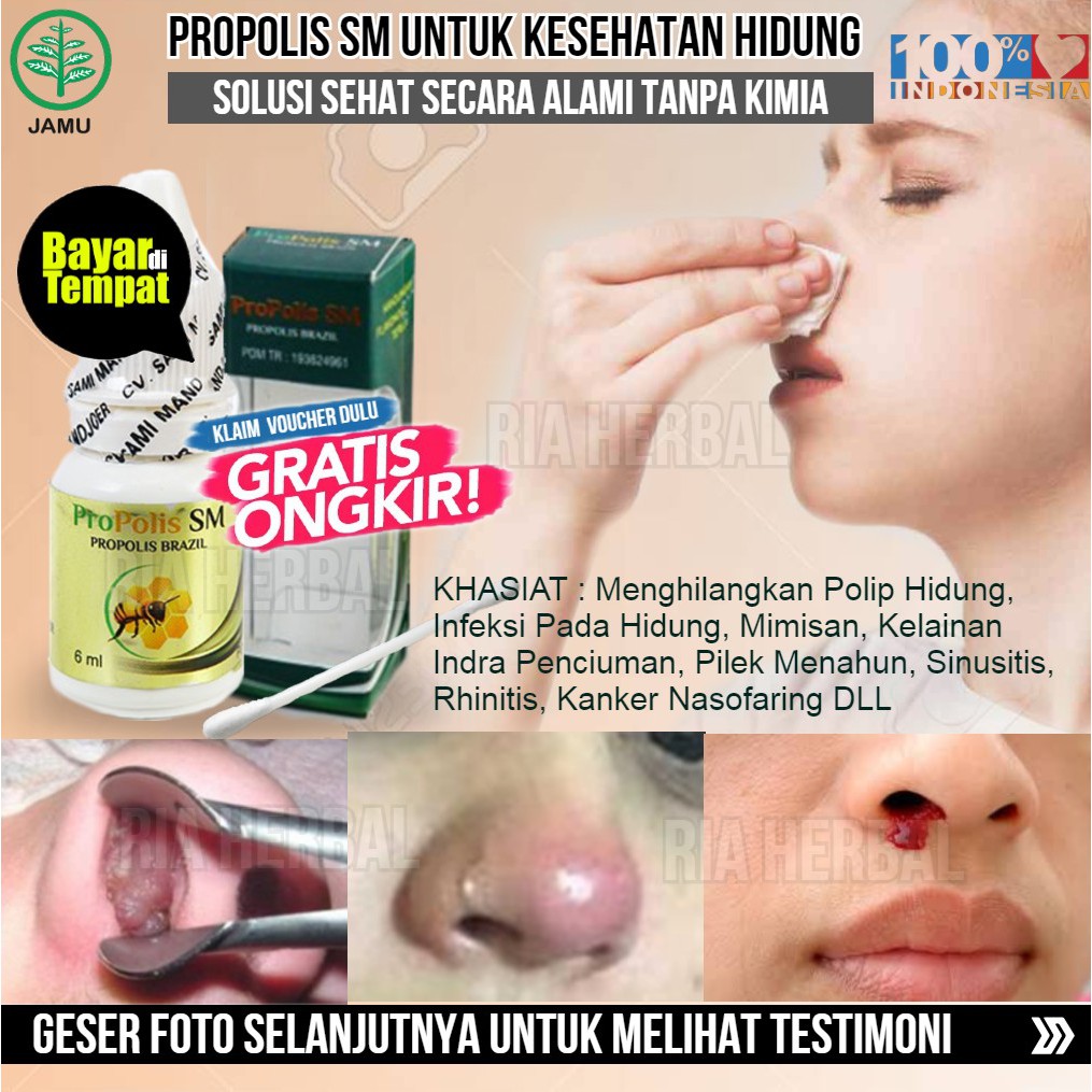 Jual Obat Hidung Tidak Bisa Mencium Bau, Kehilangan Indra Penciuman ...