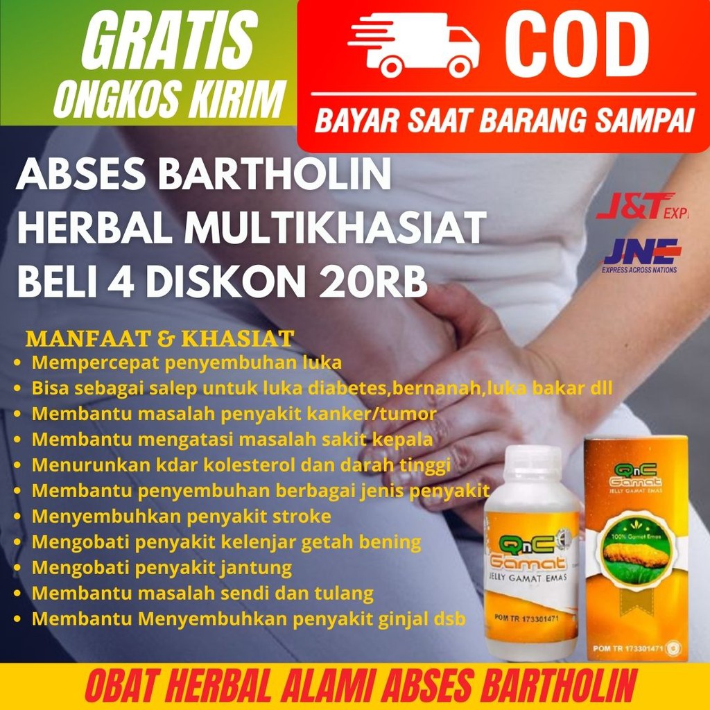 Jual Abses Bartholin-Pembengkakan-Kelenjar Bartholin-Kista Bartholin ...