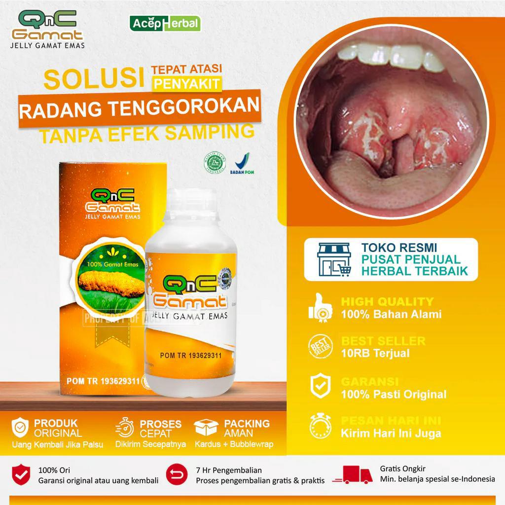 Jual Obat Radang Tenggorokan Amandel Faringitis Batuk Berdahak Infeksi ...