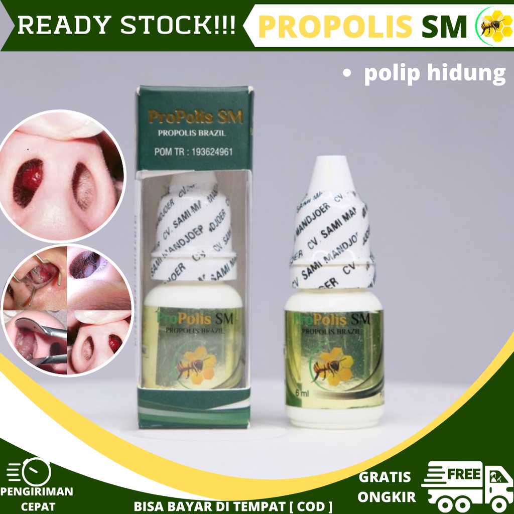 Jual Obat Sinutis, Obat Hidung Tersumbat, Pilek Menahun, Ingus Bau ...