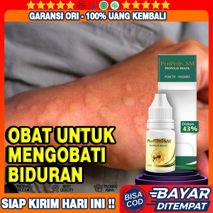 Jual Obat Biduran, Obat Kaligata, Obat Bentol Alergi, Obat Kulit Ruam ...