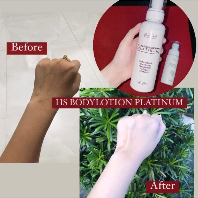 Jual HS LOTION PLATINUM BOTOL 250 ml | Shopee Indonesia
