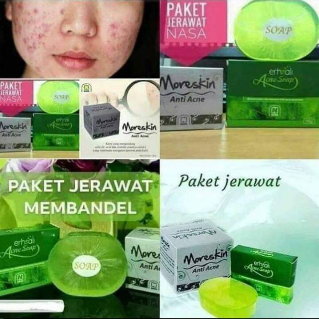 Jual Paket jerawat Nasa | Shopee Indonesia
