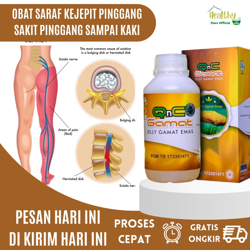 Jual Obat Saraf Kejepit, Obat Sakit Pinggang, Obat Saraf Kejepit ...
