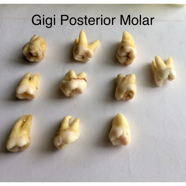 Jual Gigi asli manusia gigi posterior gigi molar utk praktikum | Shopee ...