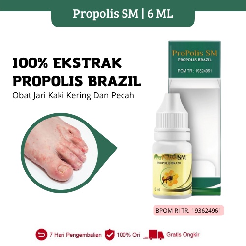 Jual Propolis SM - Obat Jari Kaki Kering Dan Pecah, Jari Kaki Sakit Dan ...
