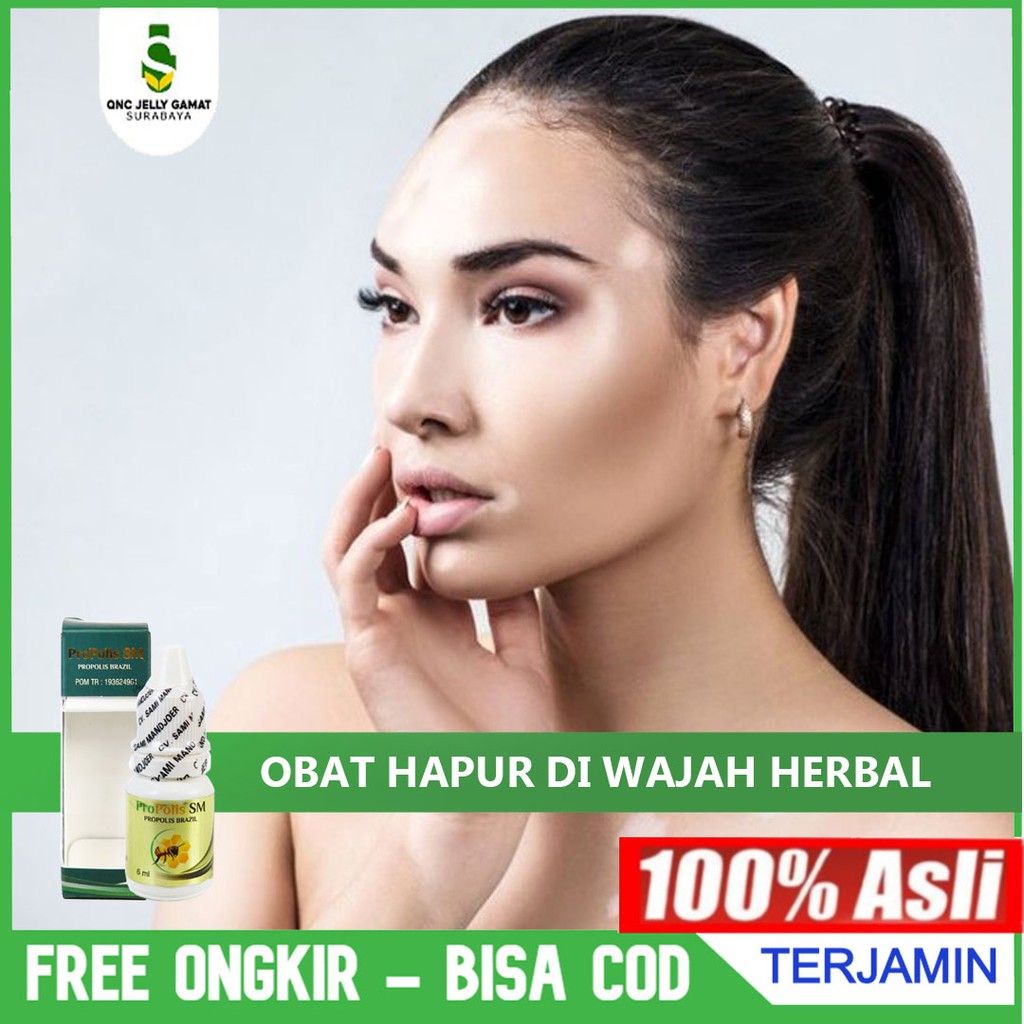 Jual Obat Hapur di Wajah - Obat Panu, Bercak Putih di Wajah Herbal ...