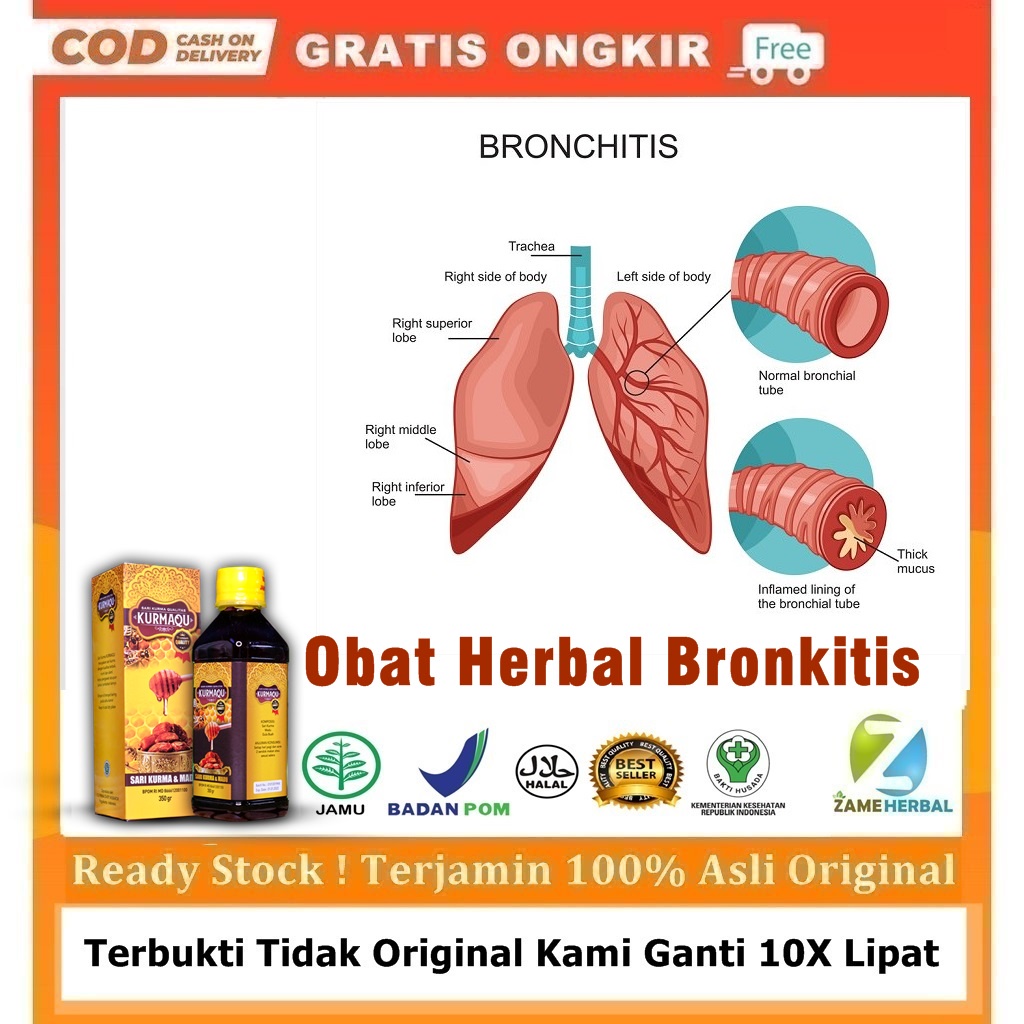 Jual Obat Bronkitis, Batuk Kering Dan Gatal, Madu Batuk Menahun, Obat ...