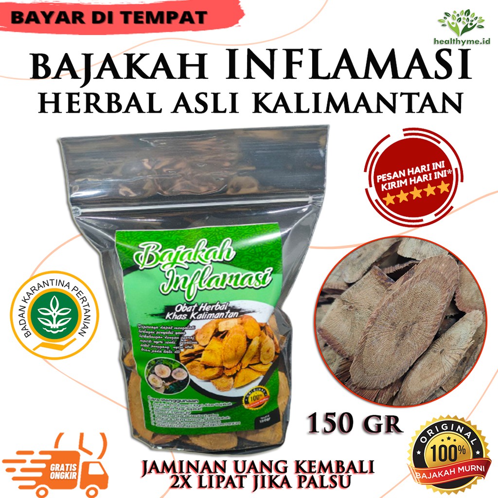 Jual Bajakah Inflamasi / Kayu Akar Bajaka Asli Kalimantan - 150 gr ...