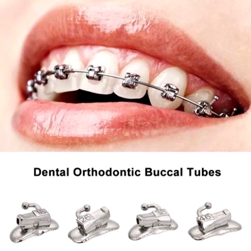 Jual Second molar tube FDA roth 022 17 27 37 47 buccal tube M2 ...