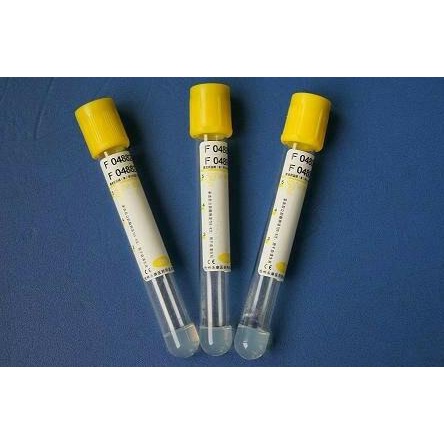 Jual Tabung Vacutainer warna kuning | Shopee Indonesia