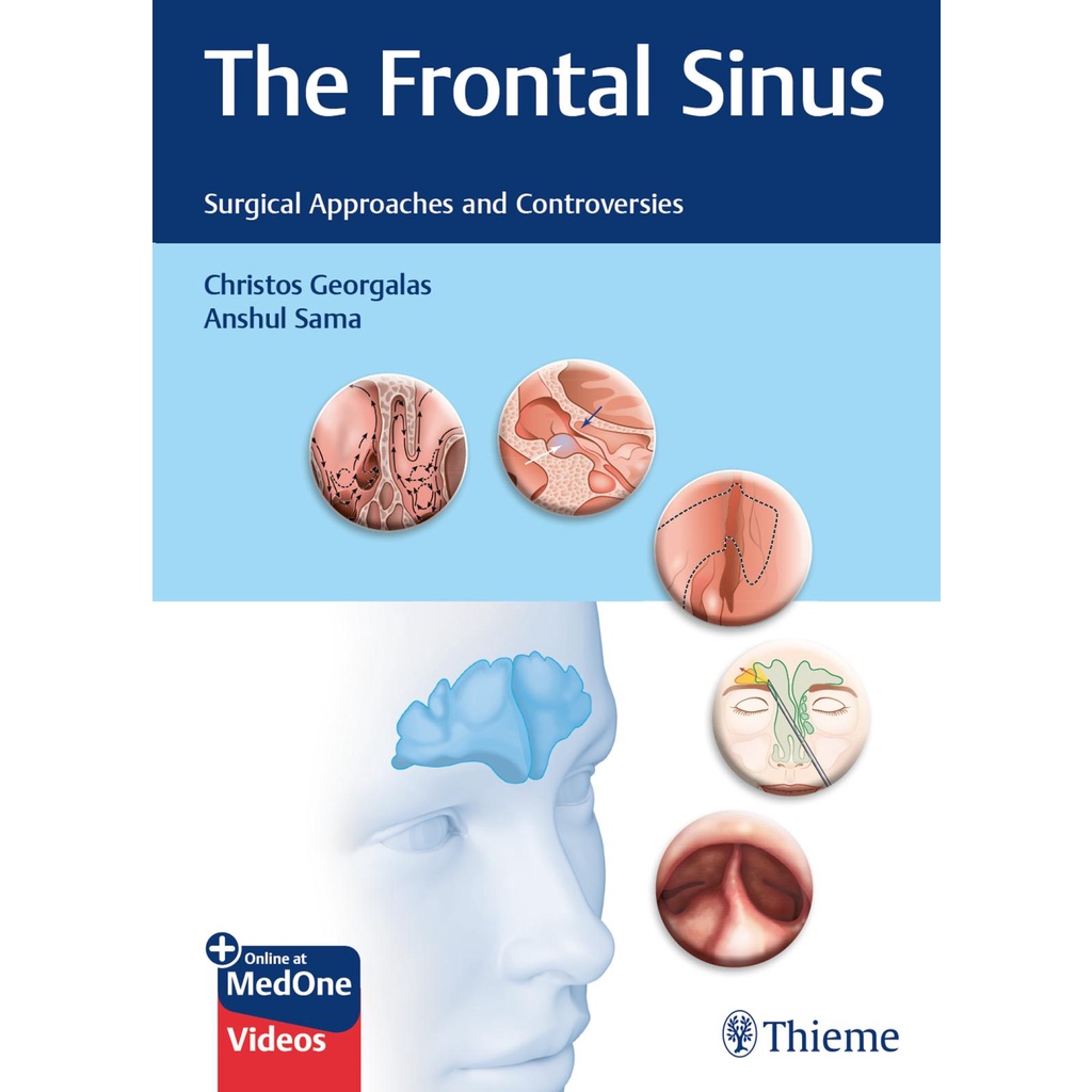 Jual The Frontal Sinus: Surgical Approaches and Controversies | Shopee ...
