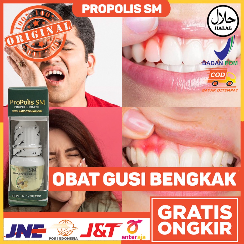 Jual Obat Gusi Bengkak - Obat Gusi Berdarah - Obat Gusi Bernanah - Obat ...