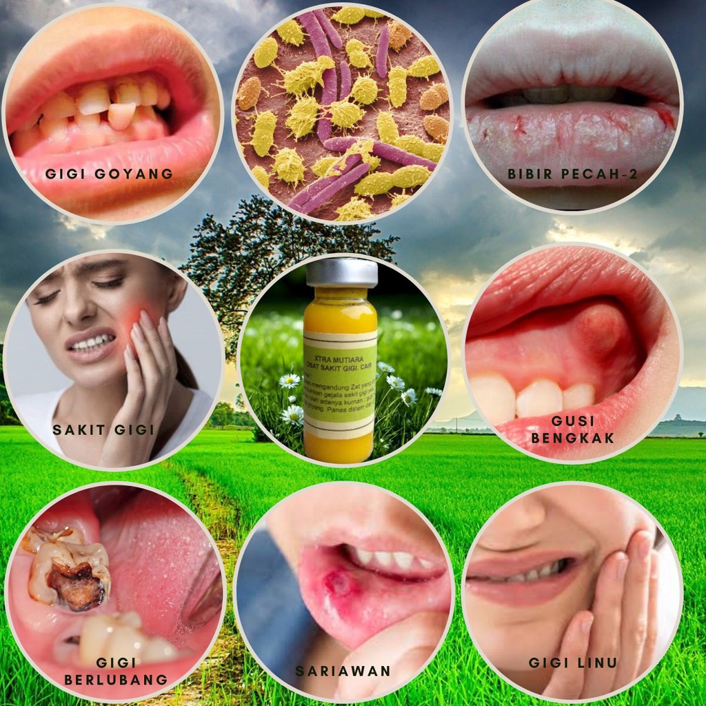 Jual obat sakit gigi(1 botol) | Shopee Indonesia