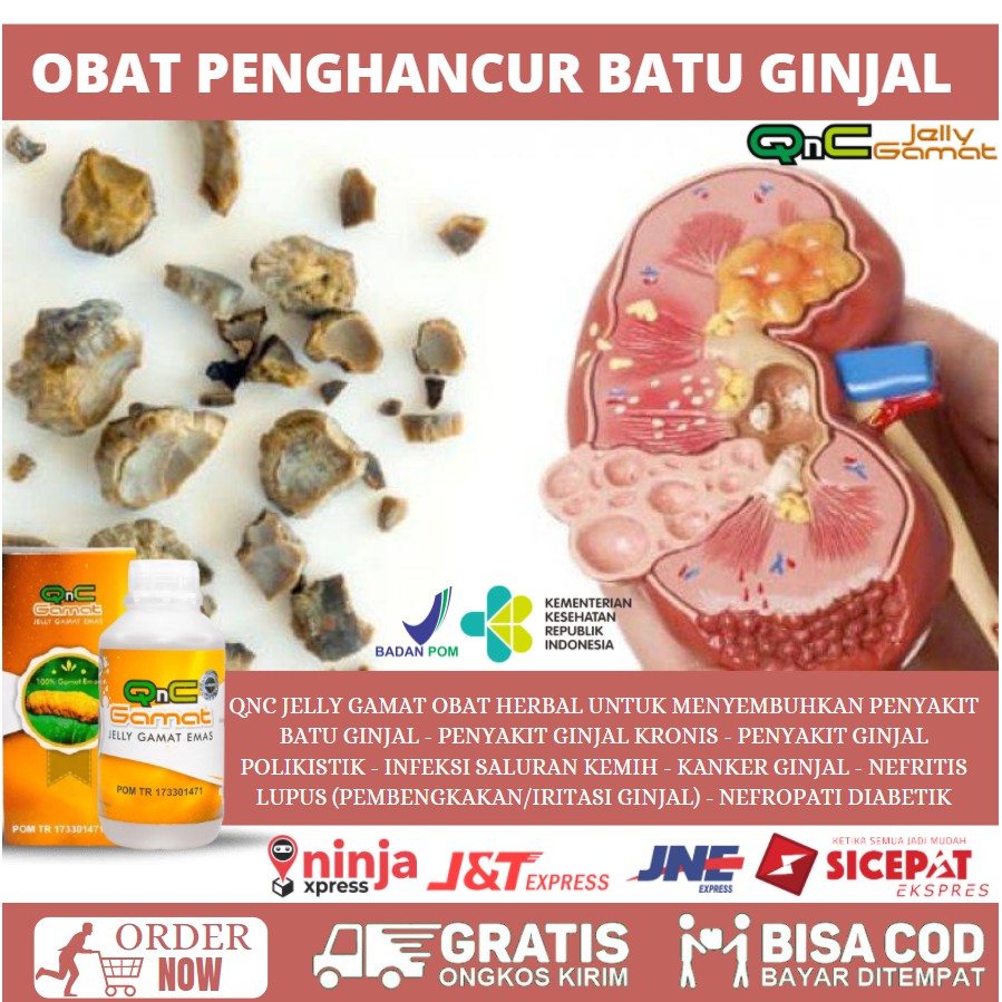 Jual OBAT HERBAL UNTUK BATU GINJAL - GAGAL GINJAL - GINJAL BOCOR - PEMBENGKAKAN / IRITASI GINJAL ...