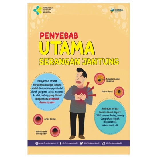 Jual Poster Kesehatan | Poster Penyebab Utama Serangan Jantung | Shopee ...