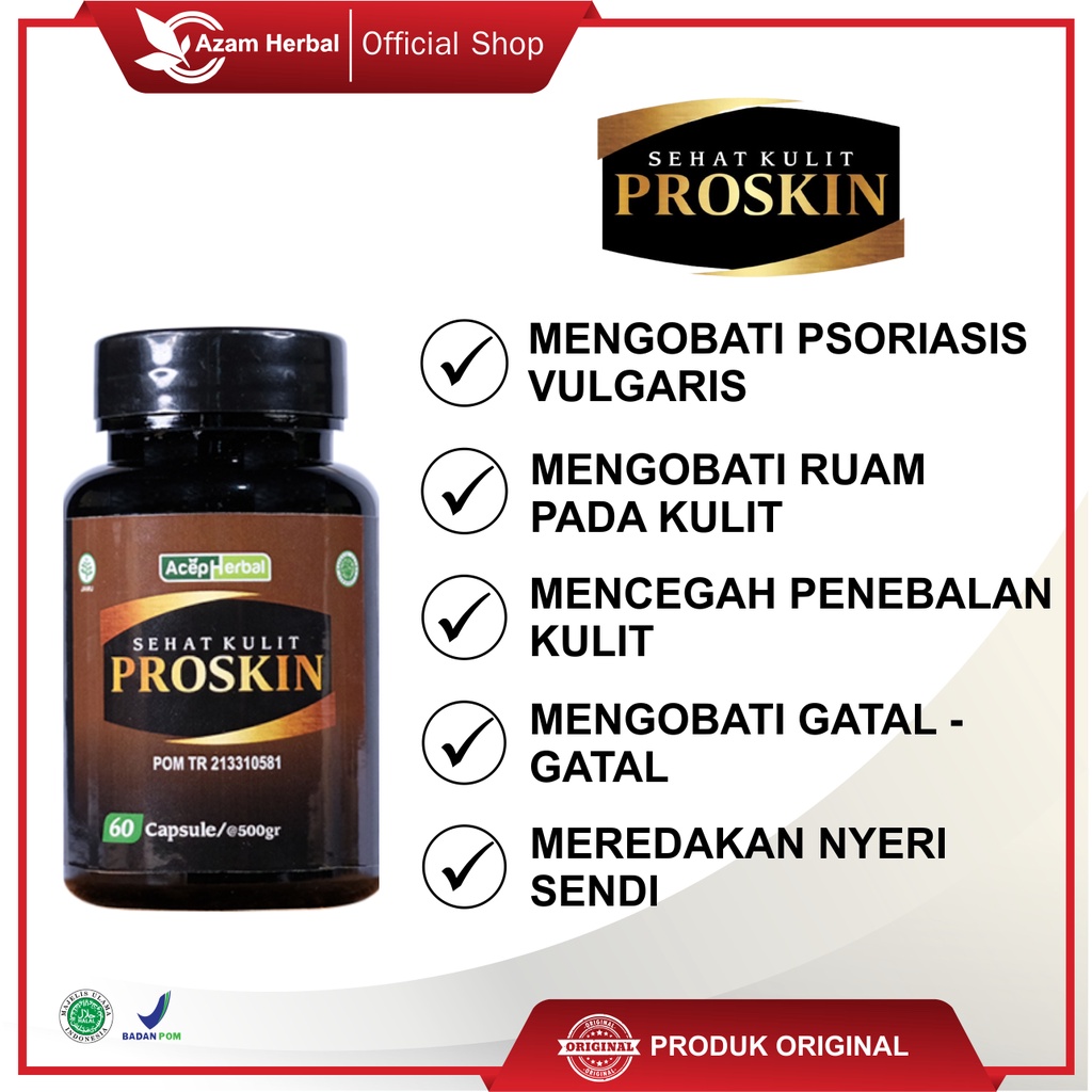 Jual Obat Psoriasis Vulgaris Kulit Kepala Gatal Bersisik Di Ketiak ...
