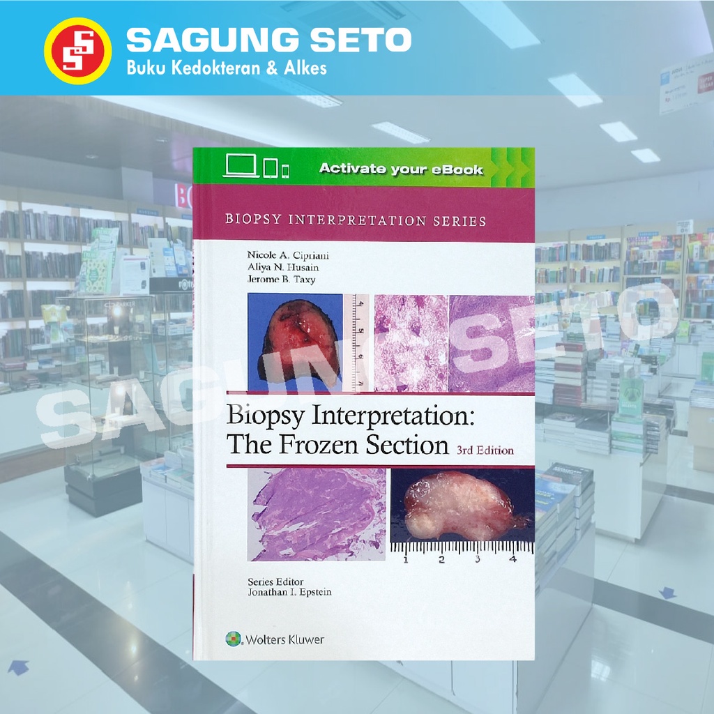 Jual BIOPSY INTERPRETATION BIOPSY INTERPRETATION : THE FROZEN SECTION ...