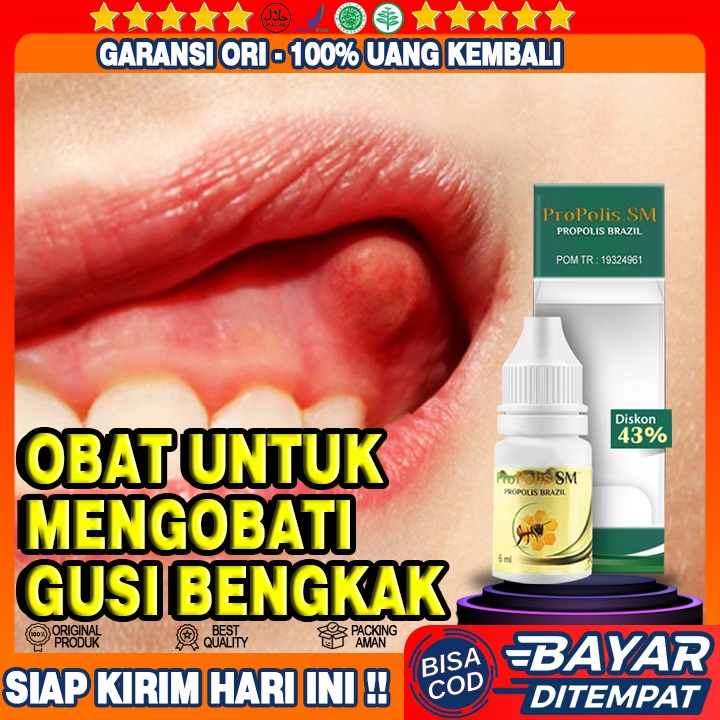 Jual Obat Gusi Bengkak, Obat Gusi Bengkak Dan Sakit, Obat Sakit Gigi Berlubang, Obat Pipi ...