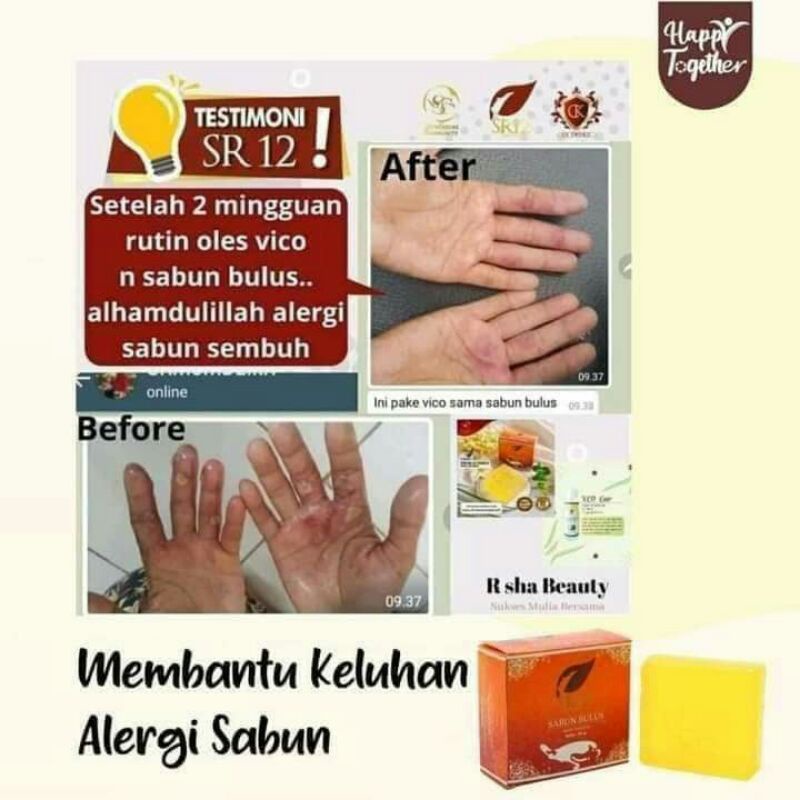 Jual Paket herbal ATASI MASALAH KULIT /obat Gatal gatal/infeksi/alergi ...